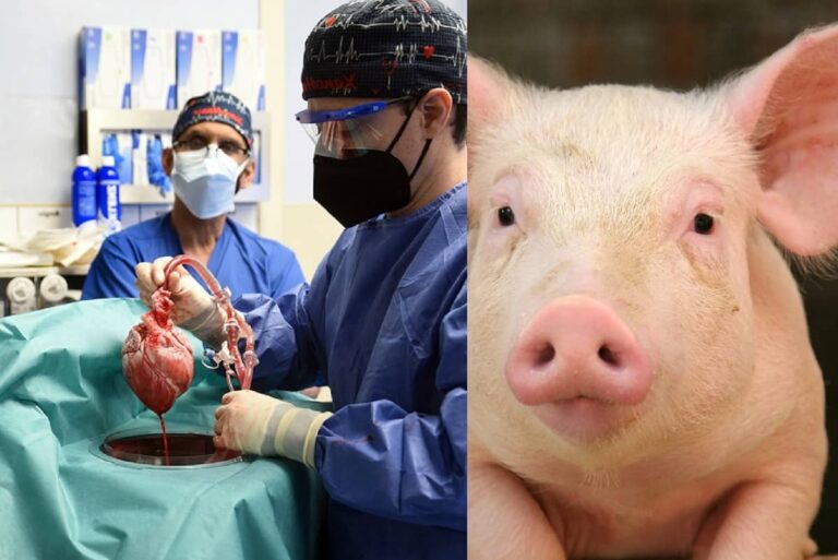 David Bennett Sr: Man who received pig heart dies after 2 months - DNB ...